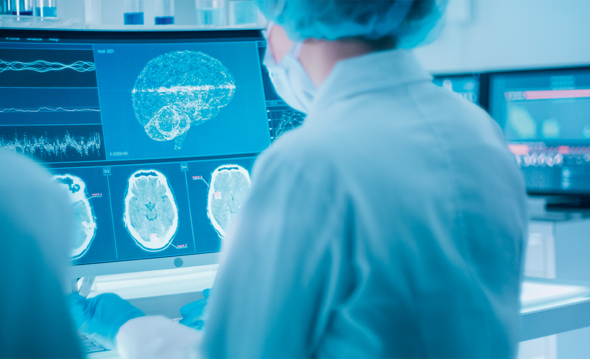 Suvremeni principi preventivnog liječenja migrene