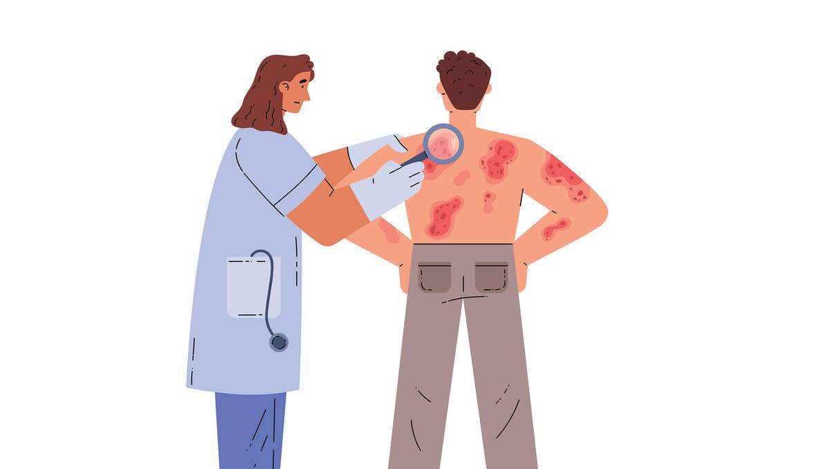 Kožna mastocitoza – pogosto prva manifestacija sistemske bolezni