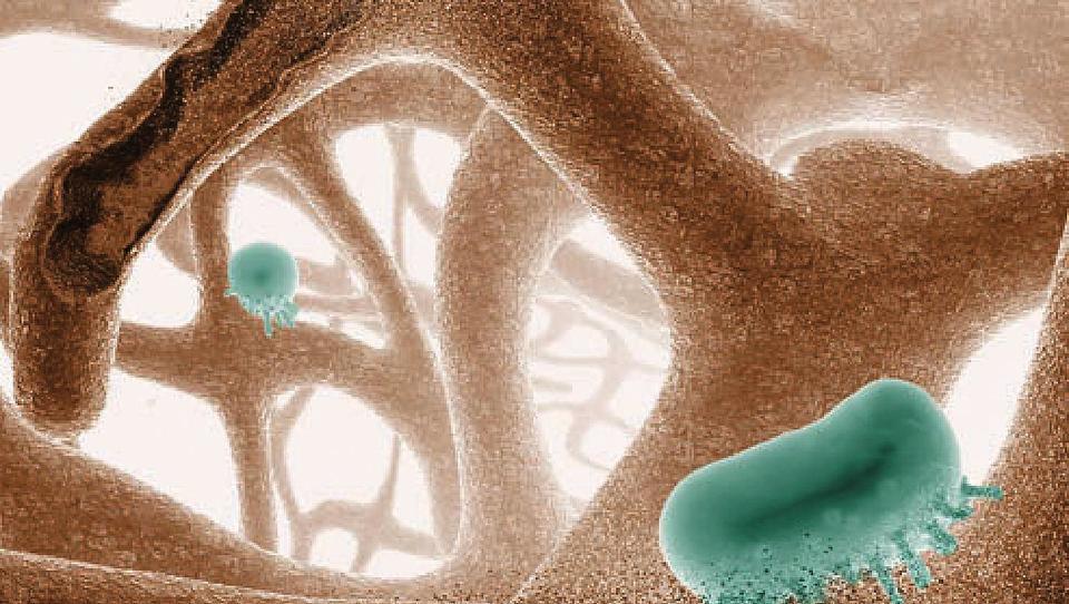 (ASCO 2021) MONALEESA-3: koristi se ohranjajo